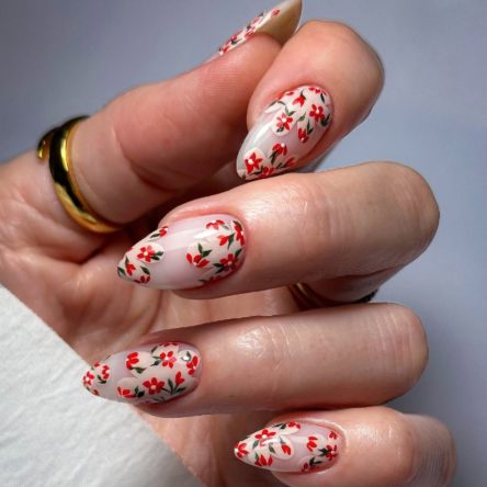 Titanium Lifting: Here’s why this aesthetic treatment has been making ...